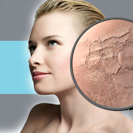 Skin Condition - Portman's Pharmacy